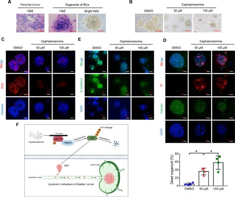 Ube2s Interacting With Trim21 Mediates The K11 Linked Ubiquitination Of Lpp To Promote The