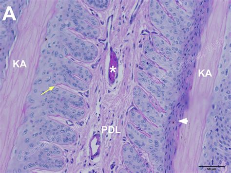 Histology From A Case Of The Laminitis Site