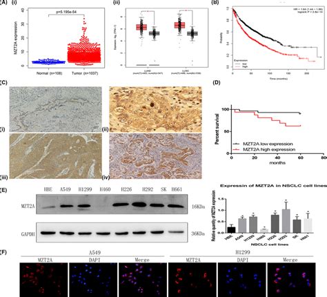 Mzt2a Overexpression And Association With Poor Nsclc Prognosis A