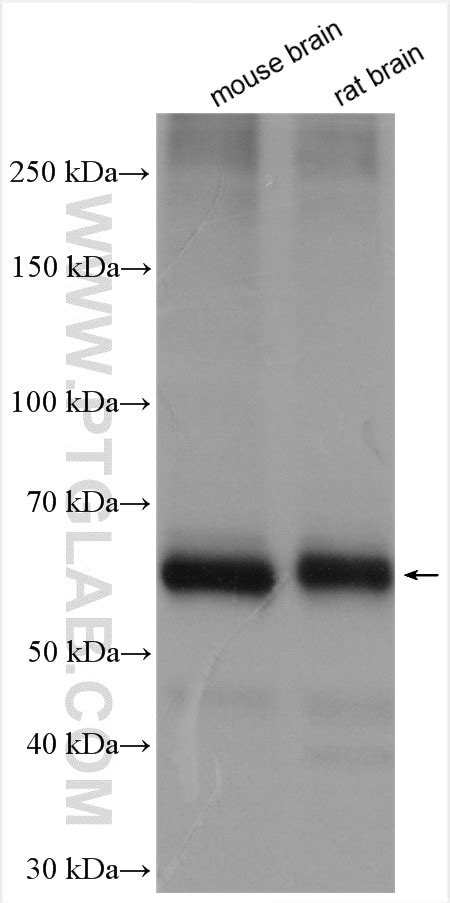Slc1a4 Antibody 13067 2 Ap Proteintech