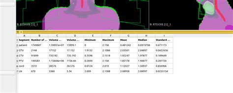 3d Slicerのsegment Statisticsの使い方 Takemura Lab