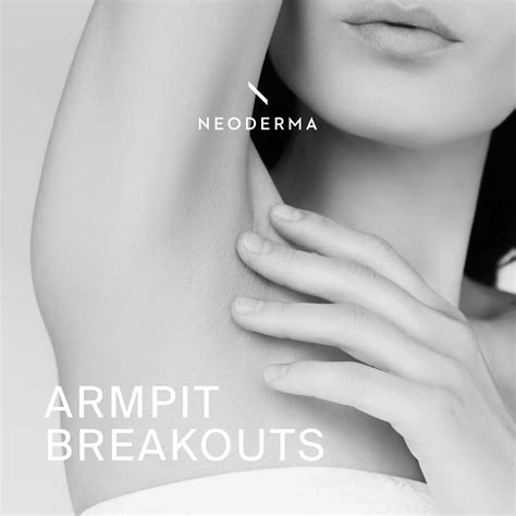 Armpit Breakouts Causes Neoderma