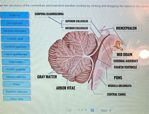 Solved Bel The Structures Of The Cerebellum And Brainstem Median Section Course Hero
