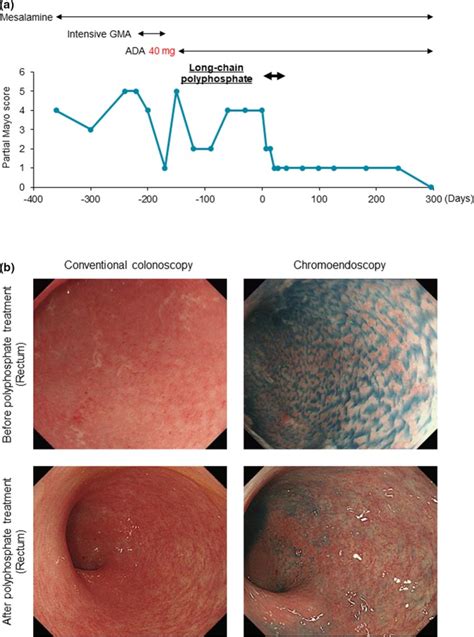 Long Chain Polyphosphate Is A Potential Agent For Inducing Mucosal
