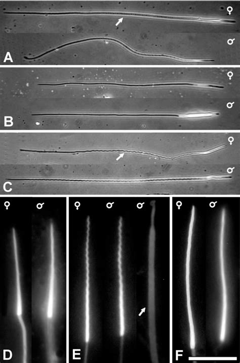 Micrographs Of Sperm Sampled From Spermathecas ♀ And Seminal Vesicles