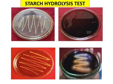 Bacteriology Practicals Pptpptx