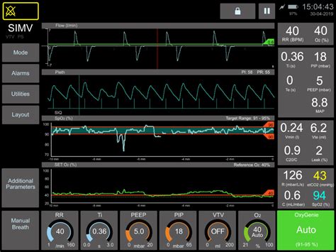 Oxygenie® Auto Fio2 Control Inspiration Healthcare