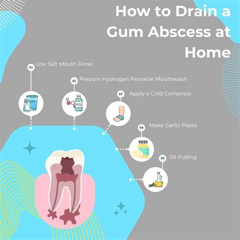 Gum Abscess Treatment 9 Effective Methods To Try At Home — Kwc Dental