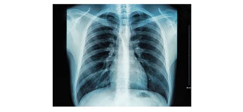 Ultraviolet X Rays And Gamma Rays Worksheets Questions And Revision Mme