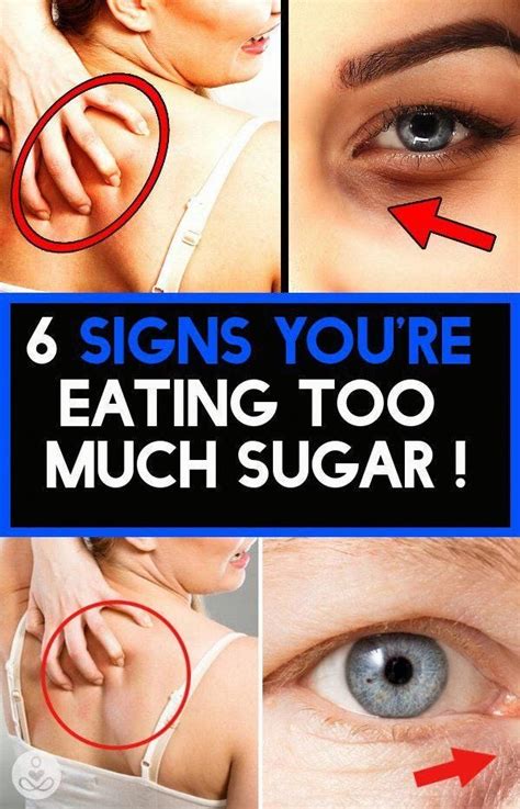 6 Indications That You Are Eating Excessive Sugar Melani Ria Medium