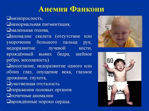 Генные болезни человека связанные с нарушением систем репарации Online Presentation