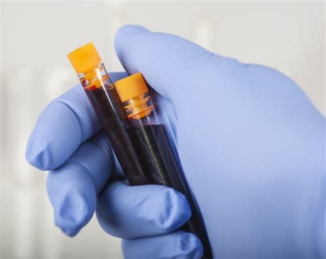 What Makes Tissue Microarray A Great Research Tool In Medical Science Attachment Research