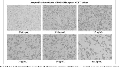 Figure 12 From Biogenic Synthesis Of Selenium Nanoparticles Using Diospyros Montana Bark Extract