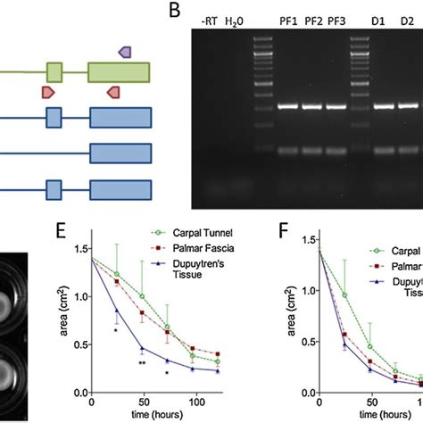 Dupuytrens Affected Tissue Expresses Epdr1 And Models Dupuytrens Download Scientific Diagram