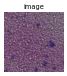 Generate Cropped Images From Spots Squidpy Documentation