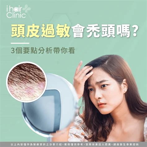 頭皮過敏會禿頭嗎？3個重點帶你了解禿髮前兆 Ihair風華御髮