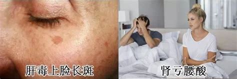 免疫细胞与健康的八大关系，值得了解一下！ 搜狐大视野 搜狐新闻