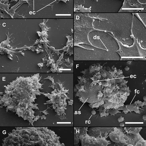 Floating Hemocyte Aggregates Transmission Electron Microscopy A Download Scientific Diagram