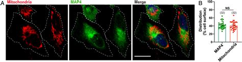 The Ubiquitous Microtubule Associated Protein 4 Map4 Controls