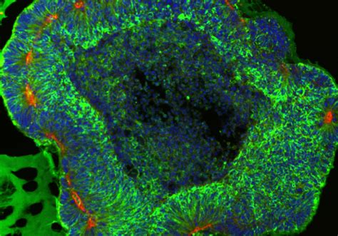 New Screening Approach Reveals Novel Regulators Of Microcephaly The Scientist