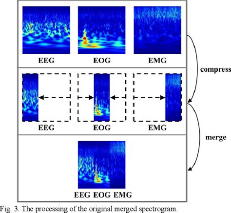 Figure From A Self Attention Based Ensemble Convolution Neural