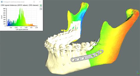 Simulation Of The Obtained Median Rami Discrepancies On An Example