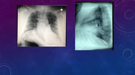Imaging Errors And Pathologies Flashcards Quizlet