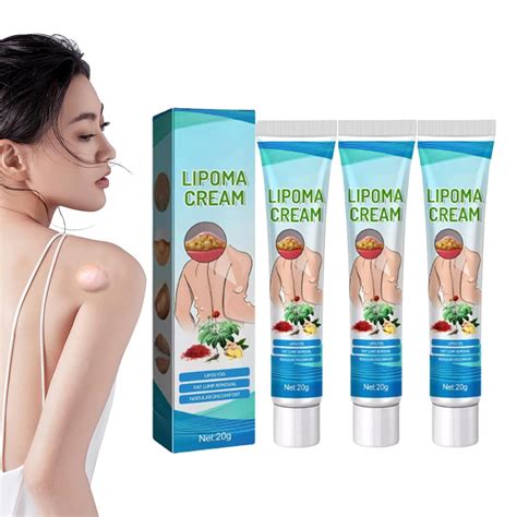 Dizhige Herbal Lipoma Removal Cream Fatty Lumps Remover India Ubuy