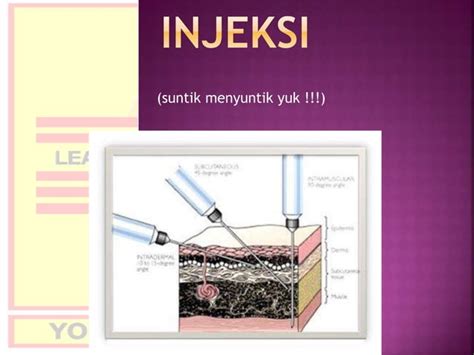Injek Pptx
