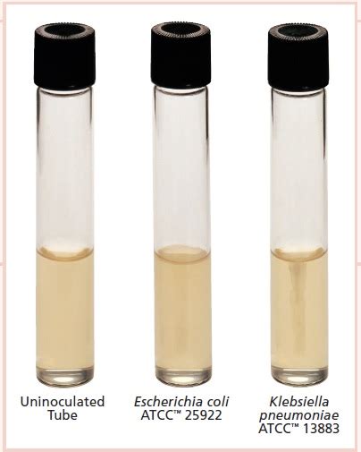 Motility Test Medium Interlab