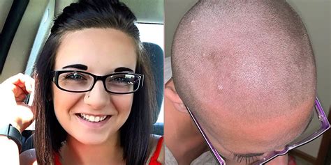 Mujer Pierde Pelo Por Acondicionador Con Crema Depilatoria