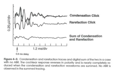 Electrophysiology Applications Of Abr Threshold Flashcards Quizlet
