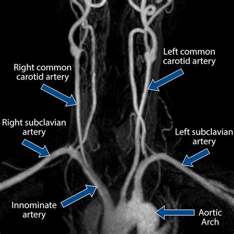 Pin By Amanda Rae On Radiology Medical Radiography Medical Anatomy