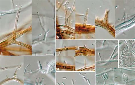 Phaeoacremonium Prunicolum A E Aerial Structures On Mea A