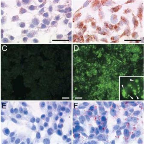 Immunofluorescent Detection Of Lc3 In Liver Tissue Few Intense