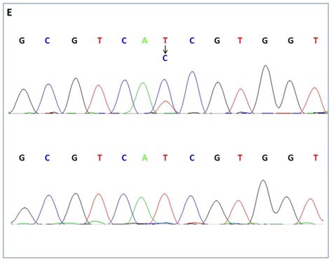 Electropherogram Showing The Identified P Ile149thr Variant In Psen2 Gene Download Scientific