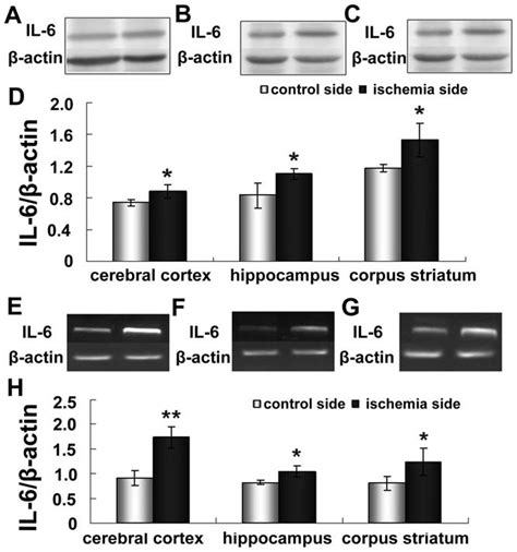 Expression Of Il 6 Mrna And Protein In Ischemic Brain Rats Were