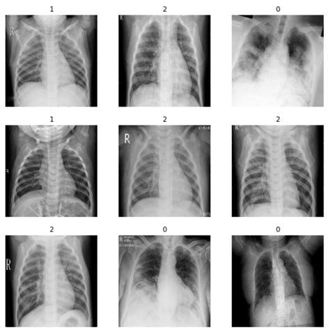 Lung Disease Classification With Explainable Ai By Abhinaykrishna T Medium