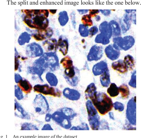 Figure 1 From Oriented Cascade Mask R CNN For Biomedical Image