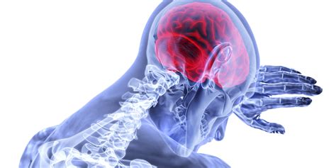 What Is Neurology Neurology Center For Epilepsy And Seizures