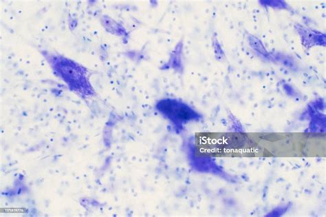 Human Nerve Cell Under Microscope