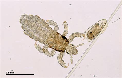 Chrysanthemums Pyrethrin And Getting Rid Of Head Lice Hubpages