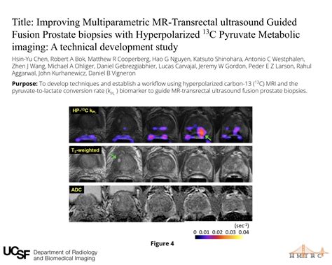 Home Hyperpolarized Mri Technology Resource Center