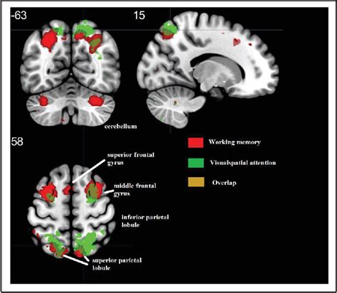 Intra Parietal Sulcus Area 1 2 And Angular Gyrus Differentiates Visual Short Term Memory And