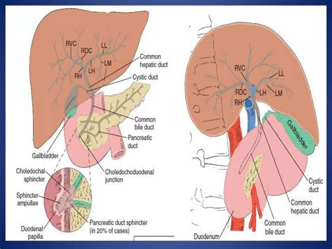 Gall Bladder Biliary Tract Anomalies And Variants PPTX