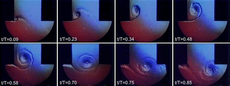 21 Periodic Vortex Formation In A Double Side Branch System In Cross