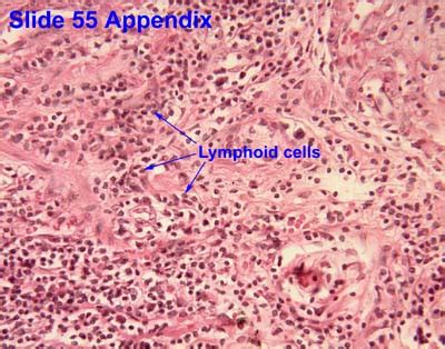 Connective Tissue Lymph Nodes