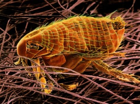 كيف تنتقل عدوى مرض الطاعون أو الموت الأسود وما أبرز أعراضه؟ الميادين