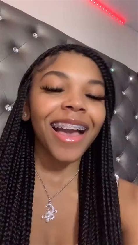 Pretty Girls With Braces
