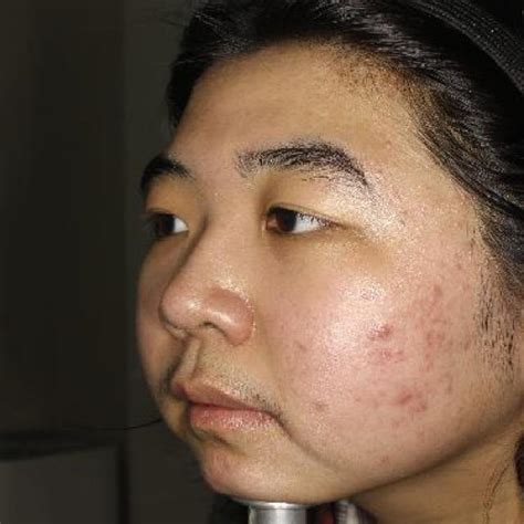 Skin Problem Multilabel Classification Dataset V Pm